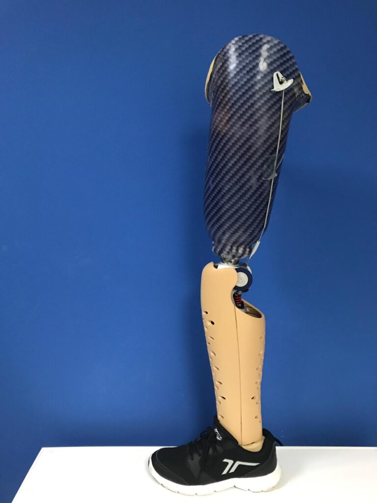 Prótesis – Ortopedia Javier Gomez